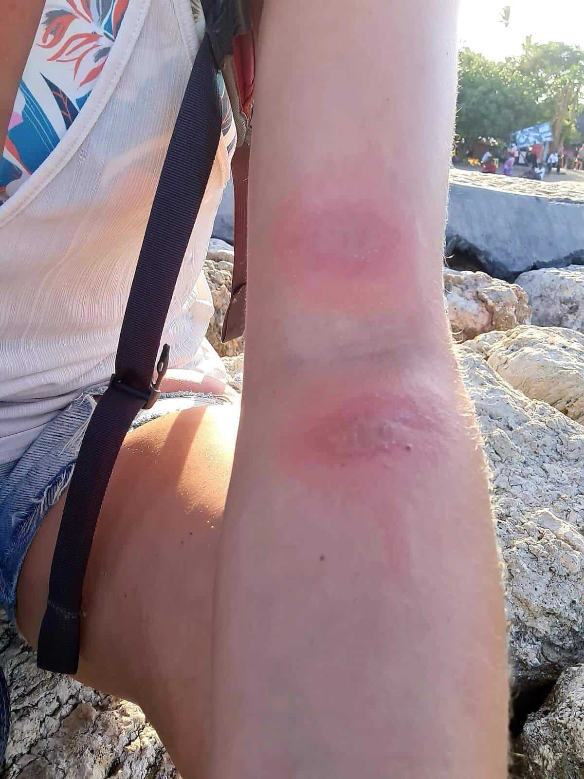 15 Best Places To Stay In Ubud For Solo Travelers